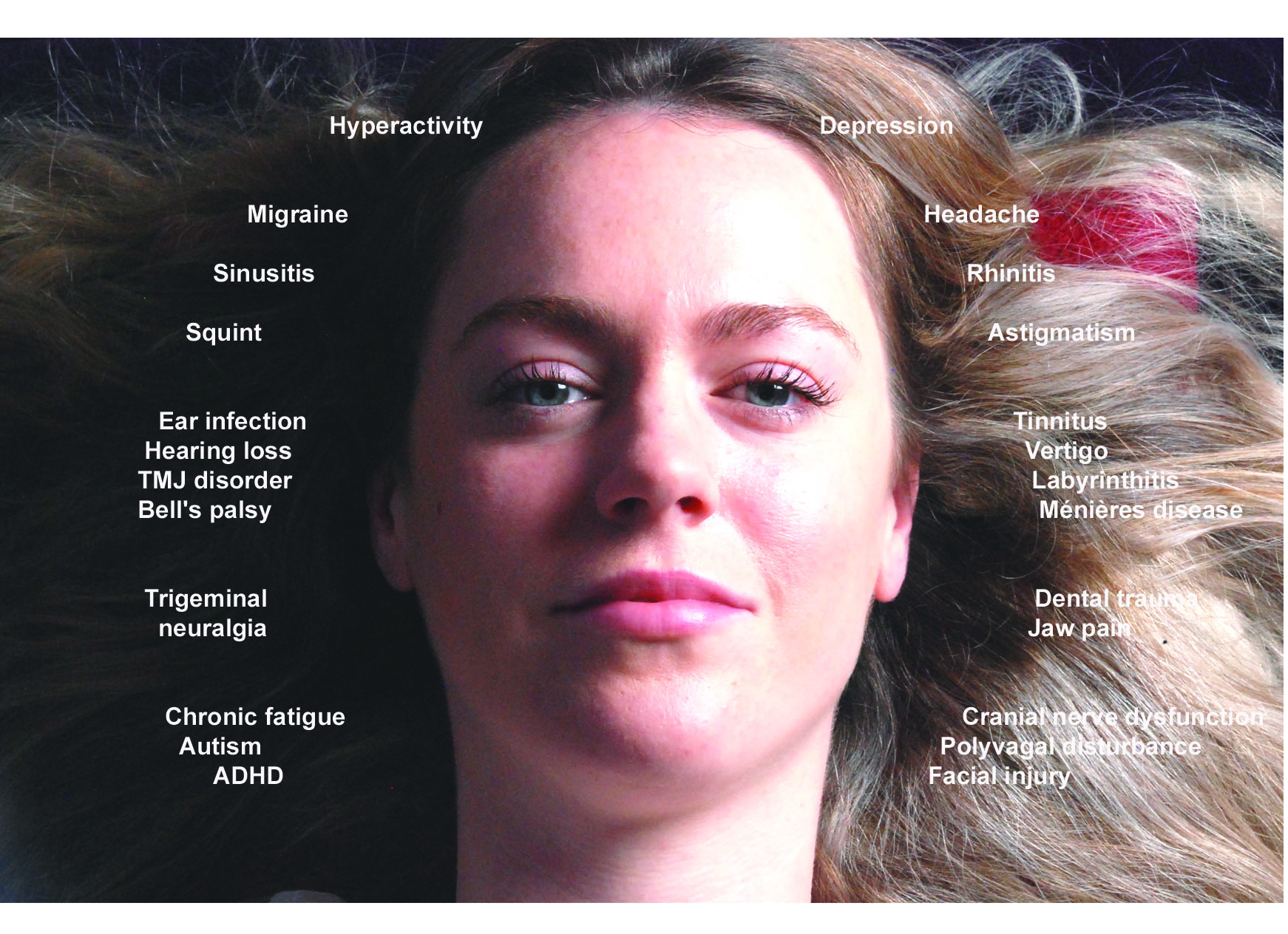 Facial Torment - and resolution - Singing Dragon and Handspring Blog